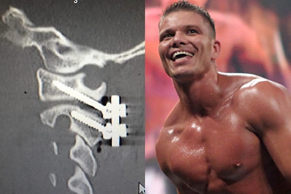 Afortunadamente sobreviví: Tyson Kidd