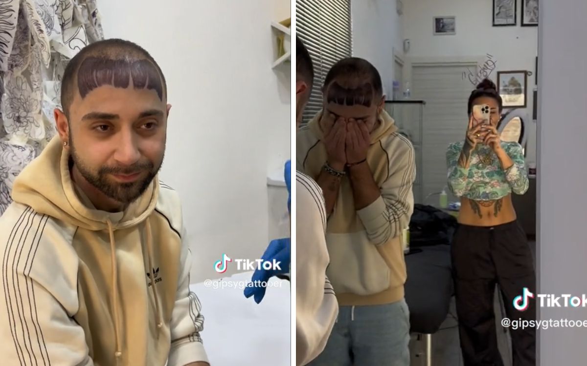 TikTok: joven-se tatúa-fleco para-ocultar calvicie-y se-hace viral