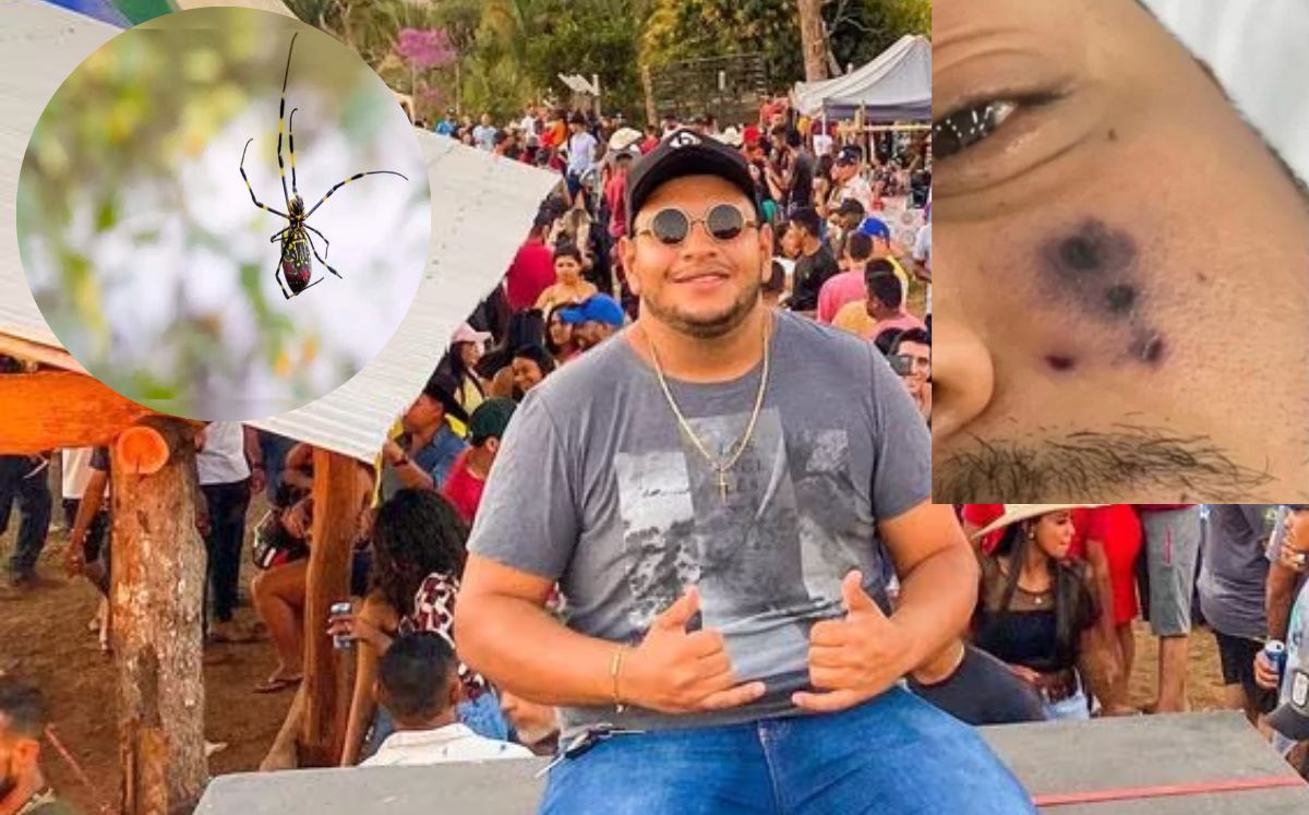 Darlyn Morais: muere famoso cantante a los 28 años por una araña