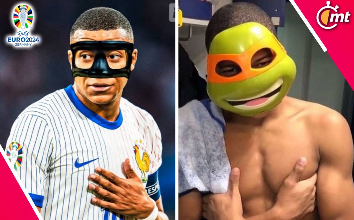 Kylian Mbappé se fractura en la Eurocopa y los memes lo destrozan