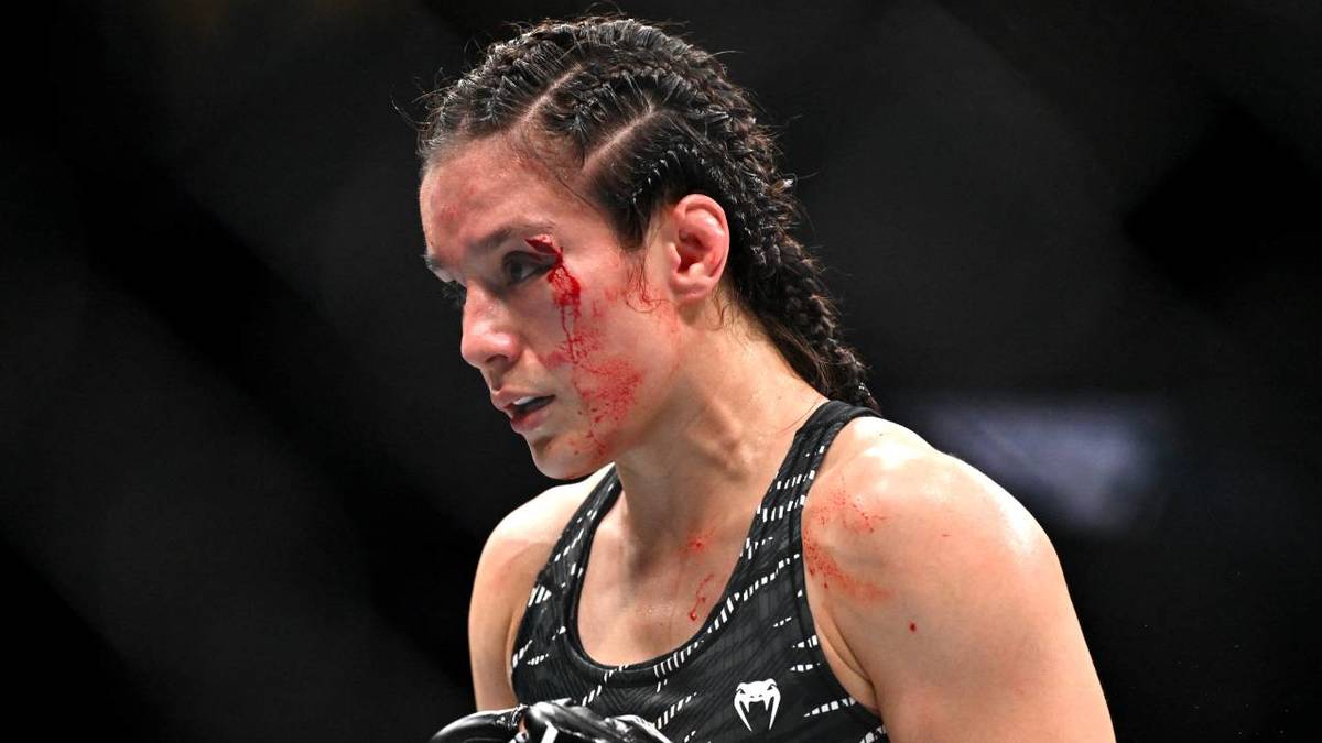 Alexa Grasso muestra su rostro lastimado tras su pelea en UFC 315